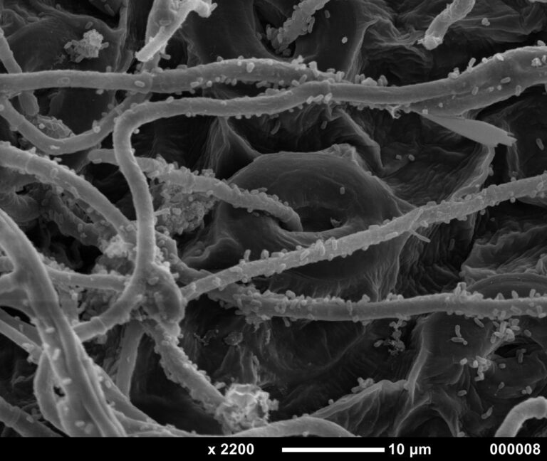 Understanding Powdery Mildew: Impact and Management